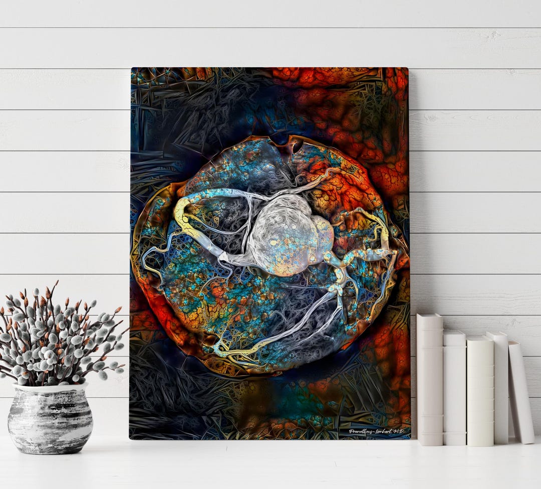 Coronary Anatomy, Canvas, Color Radiology Art Science Medical Student ...