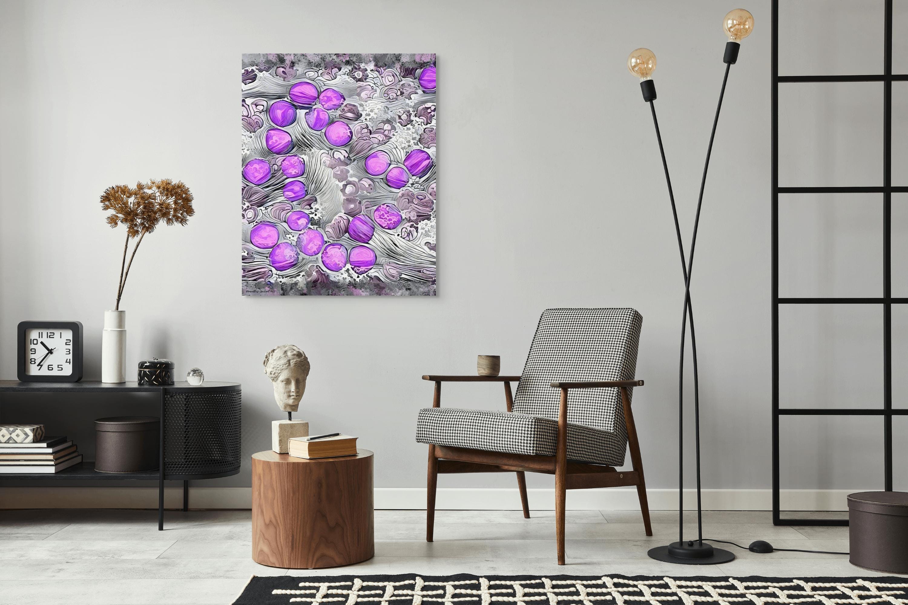 Acute Myeloid Leukemia AML, Canvas or Acrylic, “maledictus Acutis Albis ...