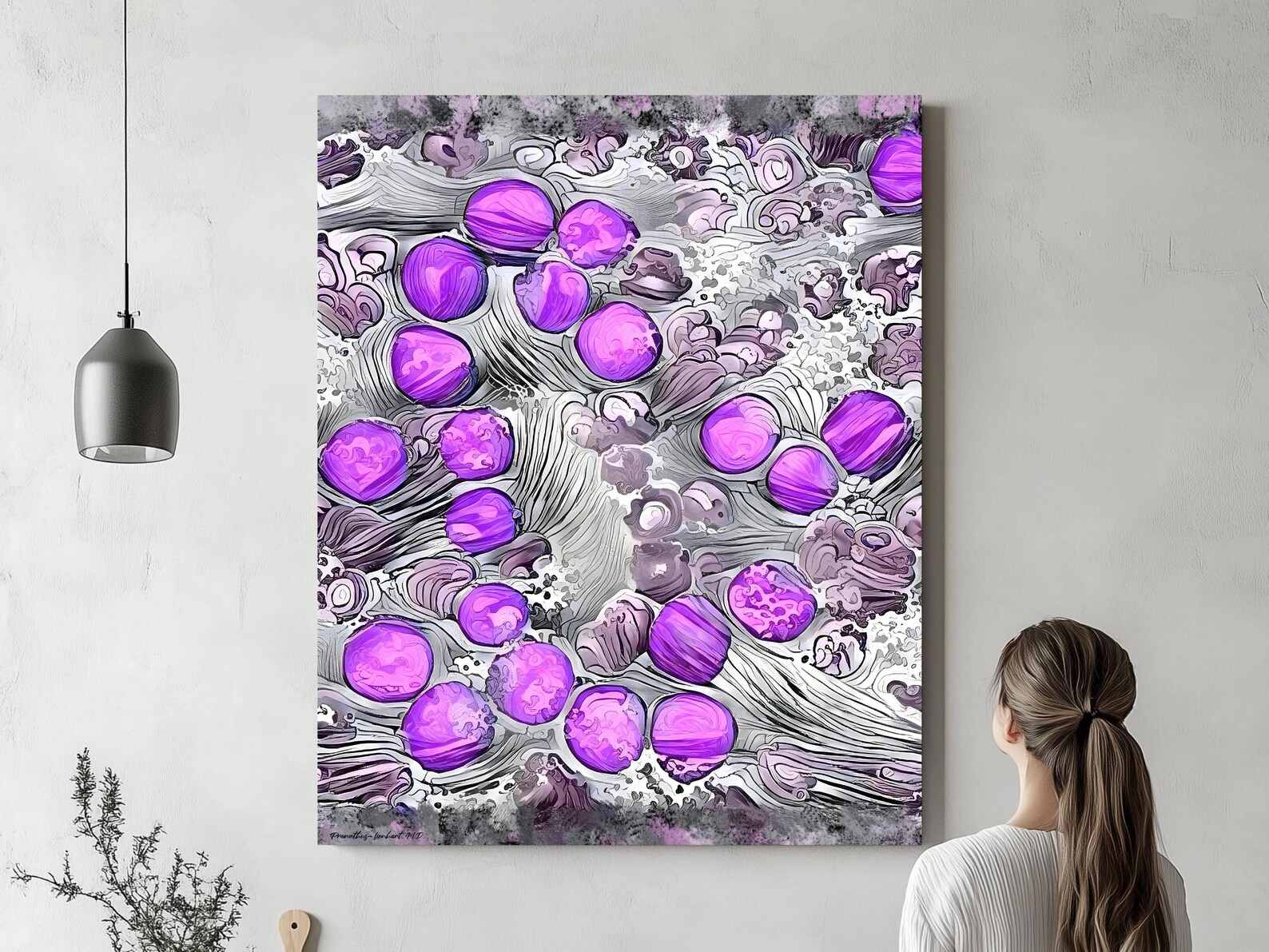 Acute Myeloid Leukemia AML, Canvas or Acrylic, “maledictus Acutis Albis ...