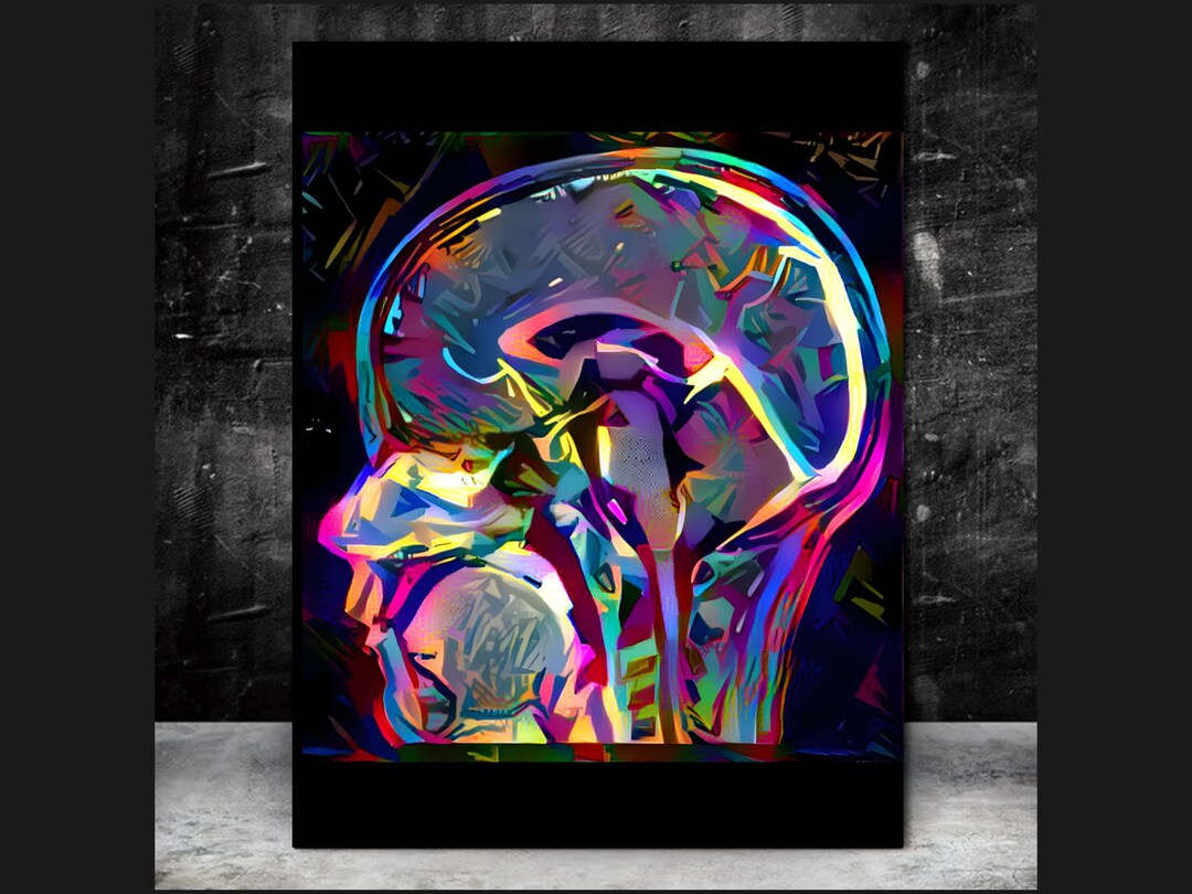 Brain Anatomy in Pop Art Style Ready to Hang Canvas, Bright Colors ...