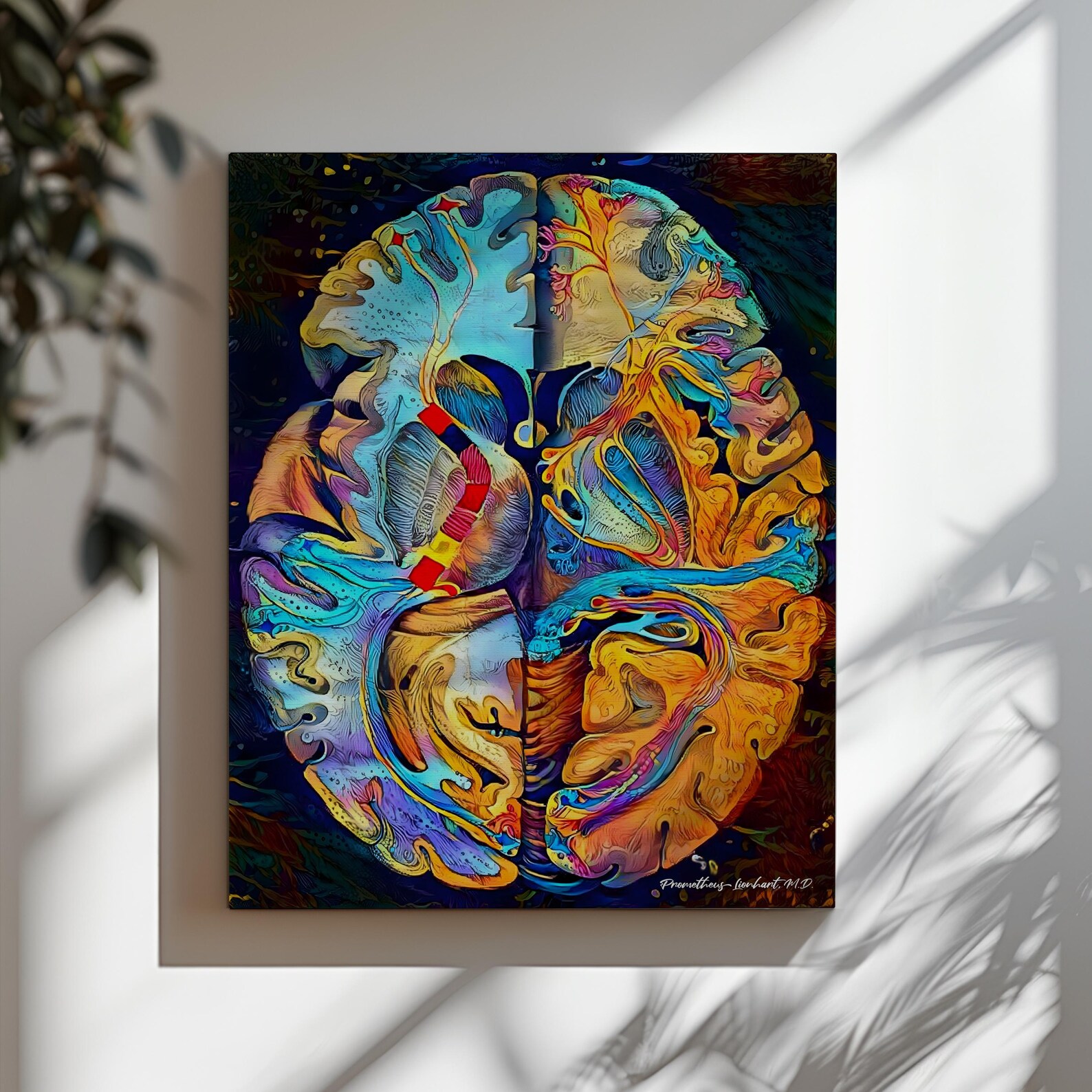 Brain Anatomy Art, Canvas or Acrylic, “alba Materia Cerebri” Doctors ...