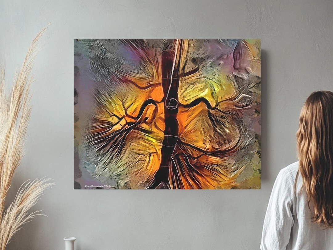 Medical Art: Renal Angiogram Canvas Print for Medical Students ...