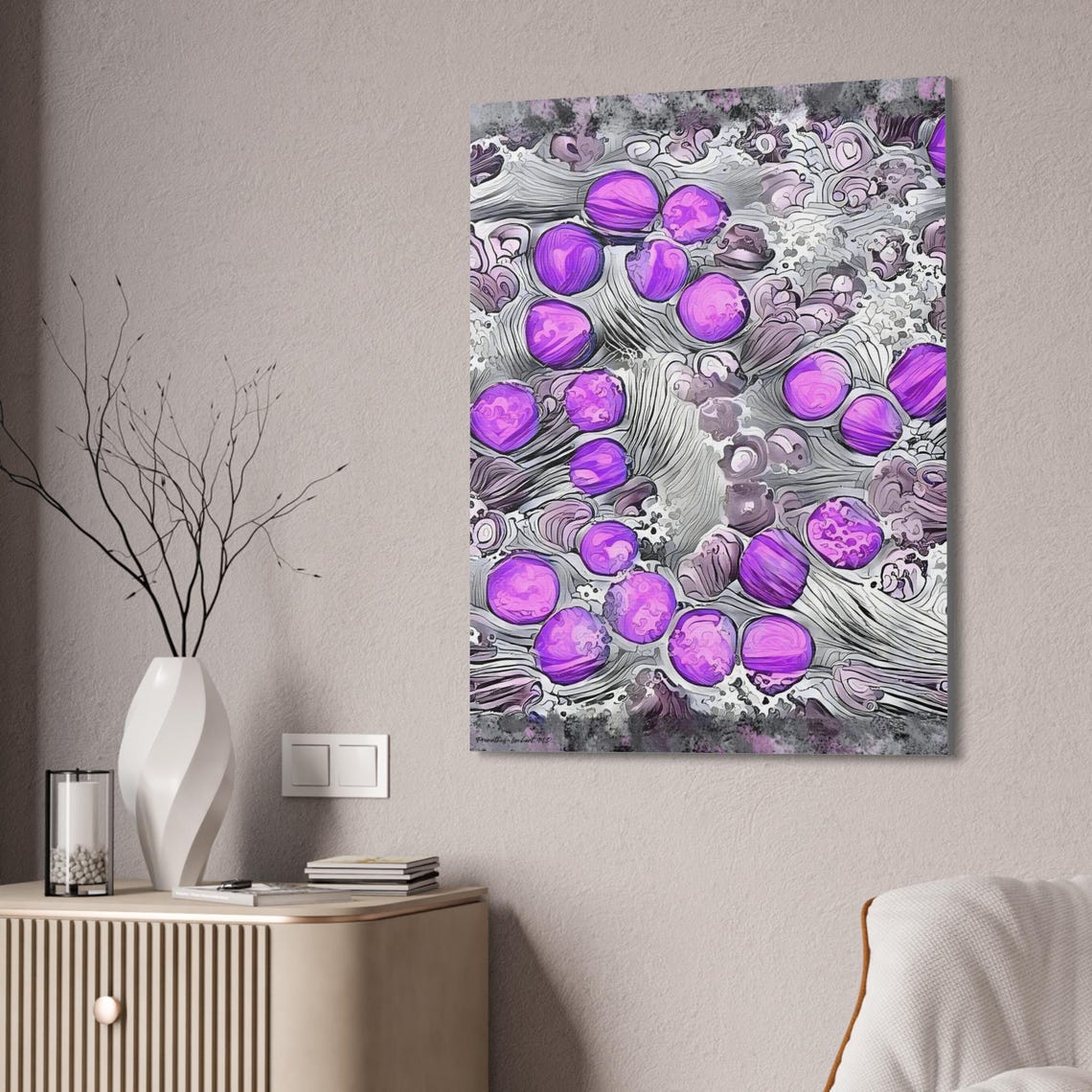 Acute Myeloid Leukemia AML, Canvas or Acrylic, “maledictus Acutis Albis ...