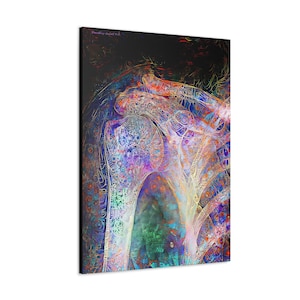Shoulder Anatomy in Bright Color - Ready to Hang Canvas - Anatomy ...