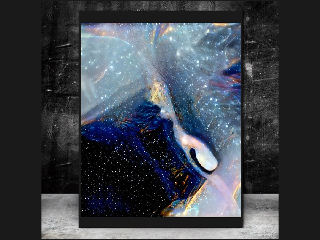 Esophagus Anatomy Canvas Zenker GI Radiology Wall Art - Etsy