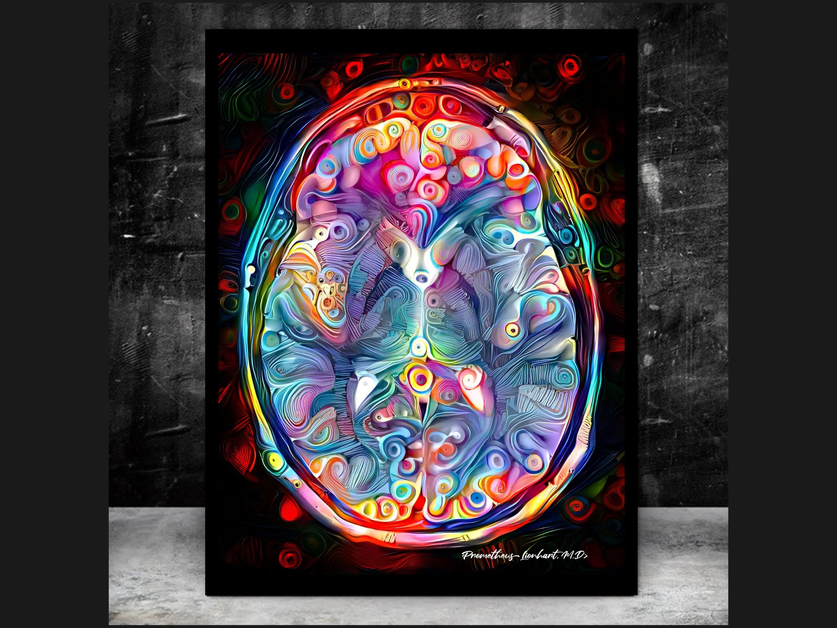 Brain Anatomy Art Canvas Rainbow Axial Radiology Wall Art - Etsy
