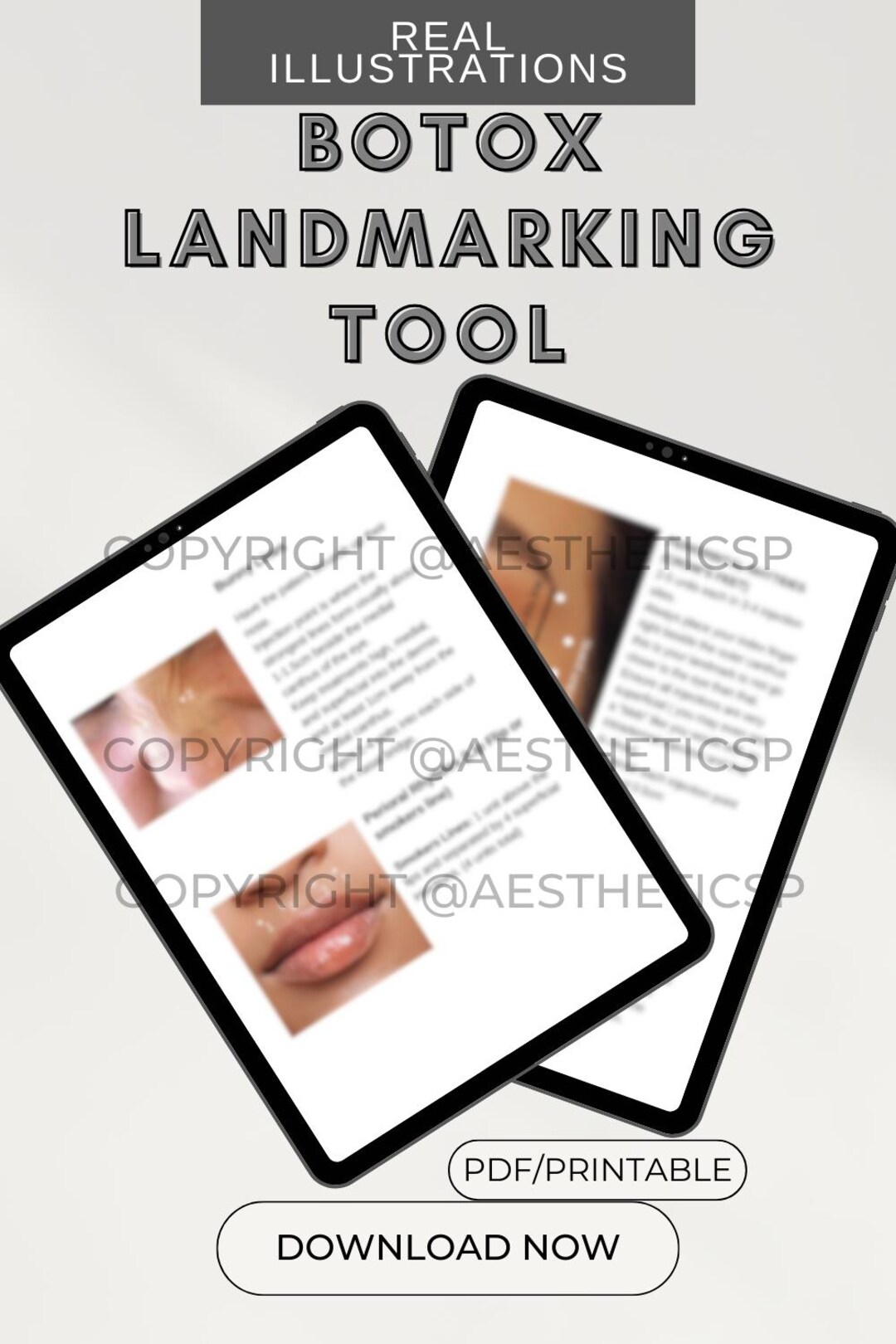 Botox Injection Landmarks, Dosage Cheat Sheet, Injector Guide (prints ...