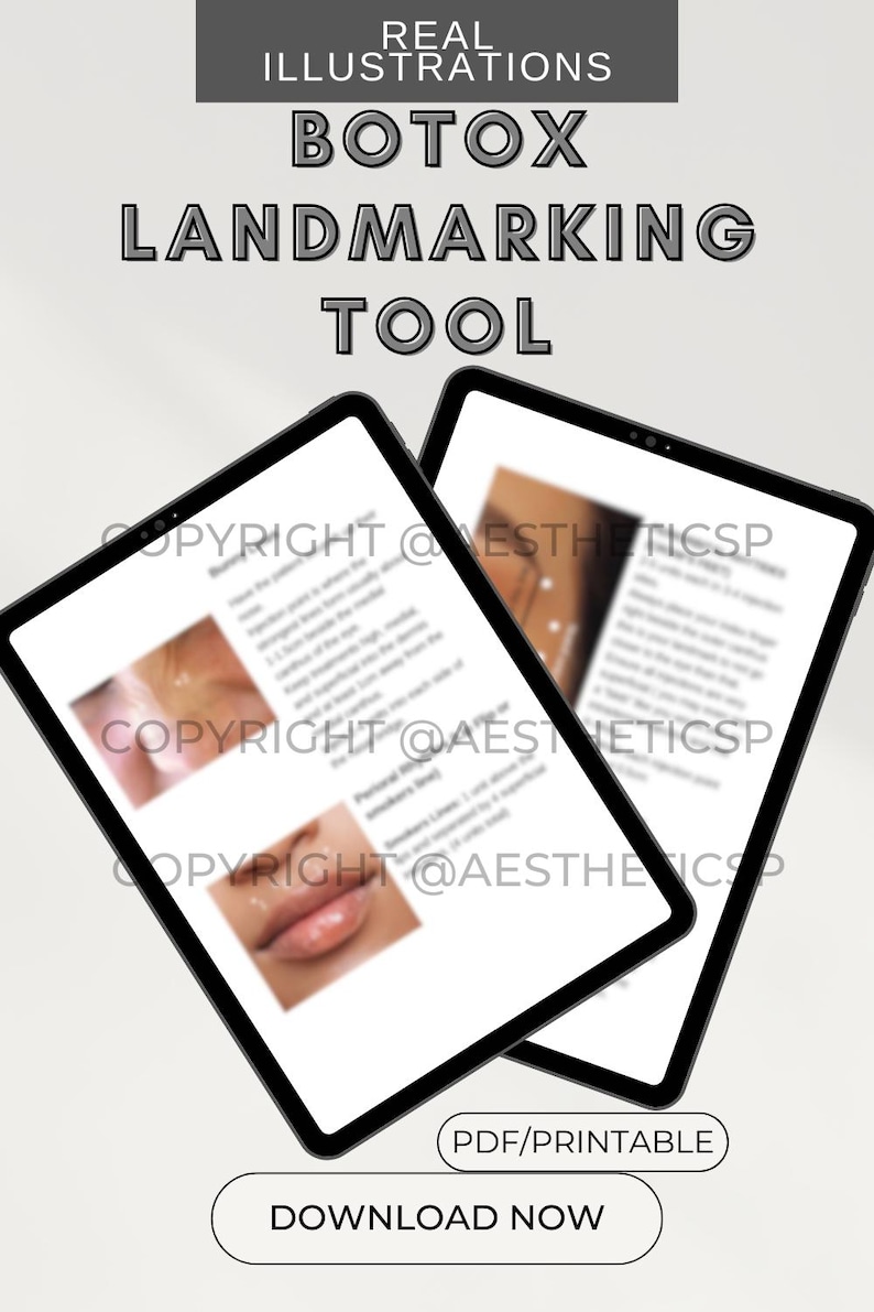 Botox Landmark and Dosage Cheat Sheet for Aesthetic Injectors, Study ...