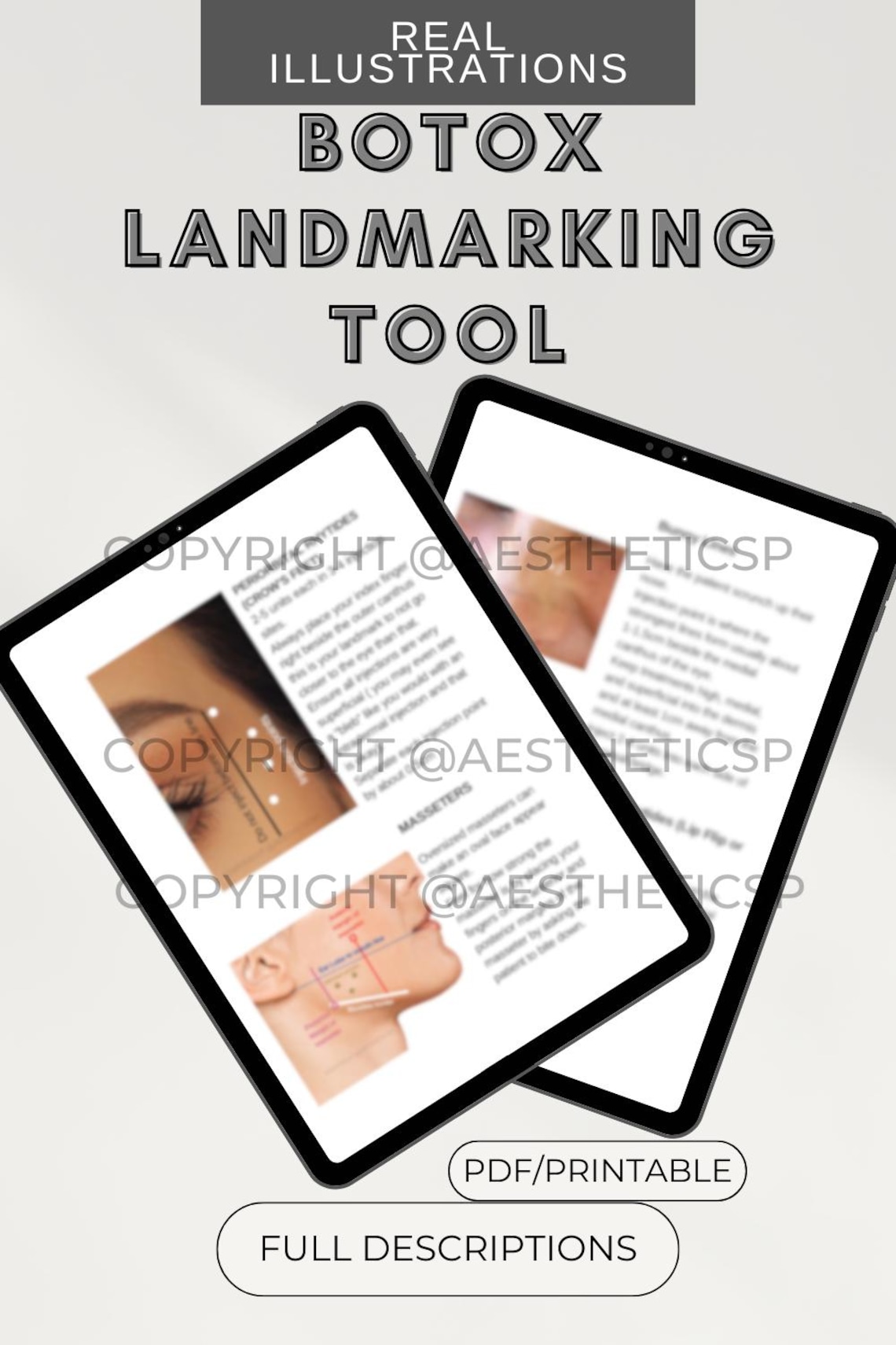 Botox Landmark and Dosage Cheat Sheet for Aesthetic Injectors, Study ...