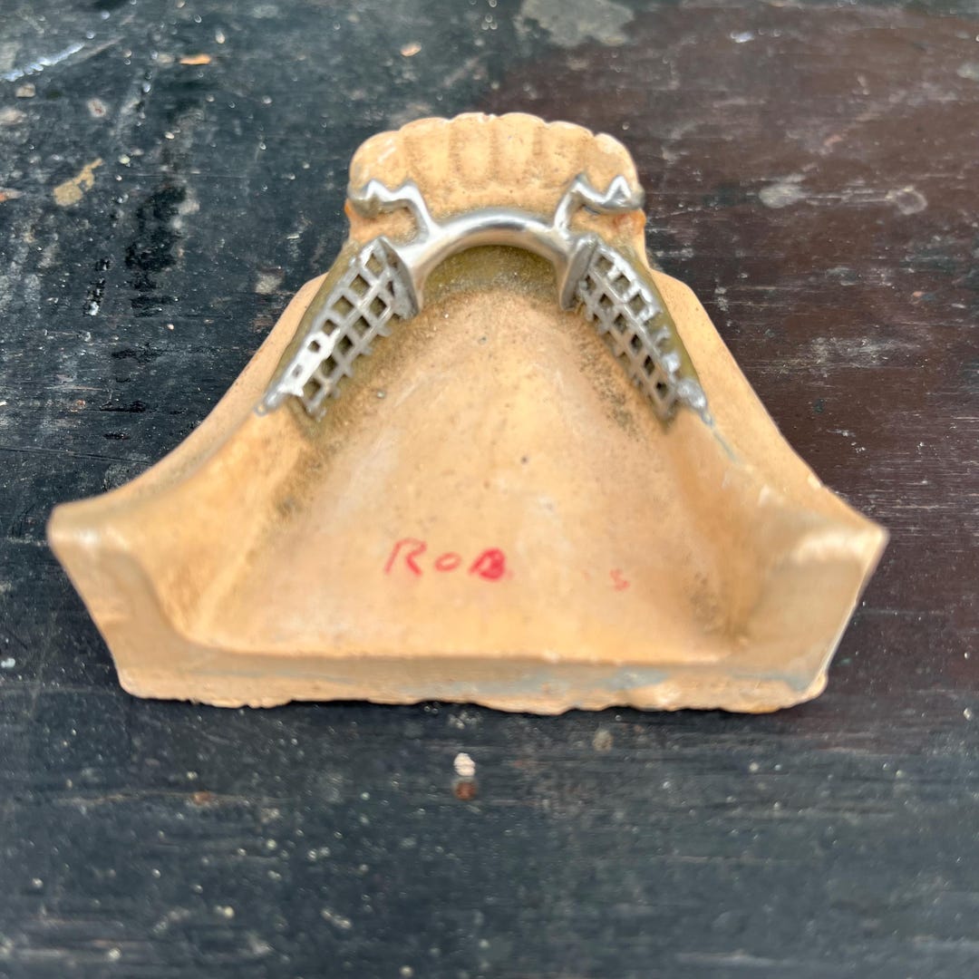 Vintage Plaster Cast Mouth Dental Retainer Braces Medical Mold - Etsy