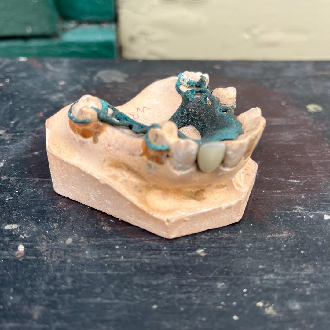 Vintage Plaster Cast Mouth Dental Retainer Braces Medical Mold - Etsy