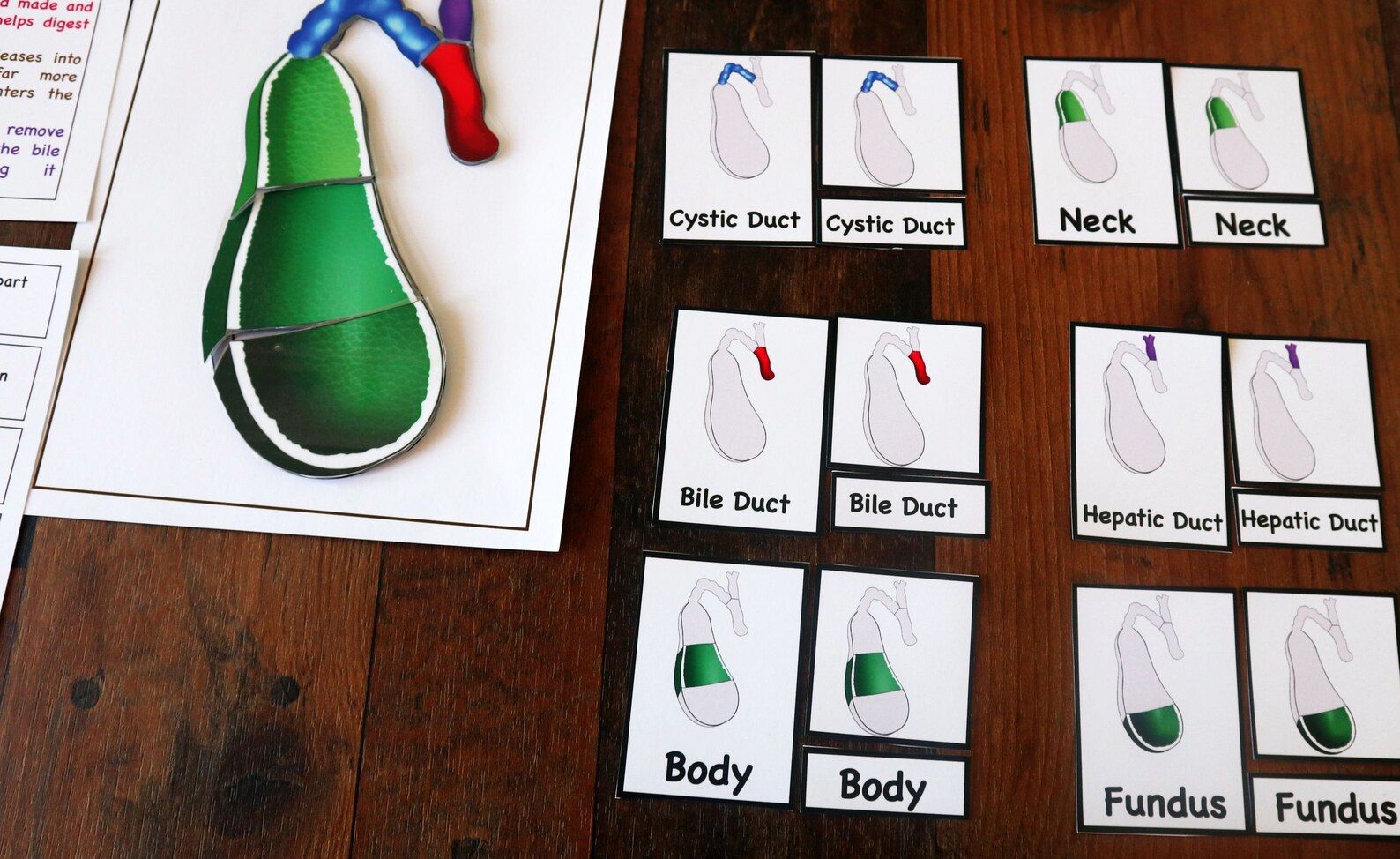 Human Gallbladder Anatomy Printable Activity, Gallbladder Puzzle ...