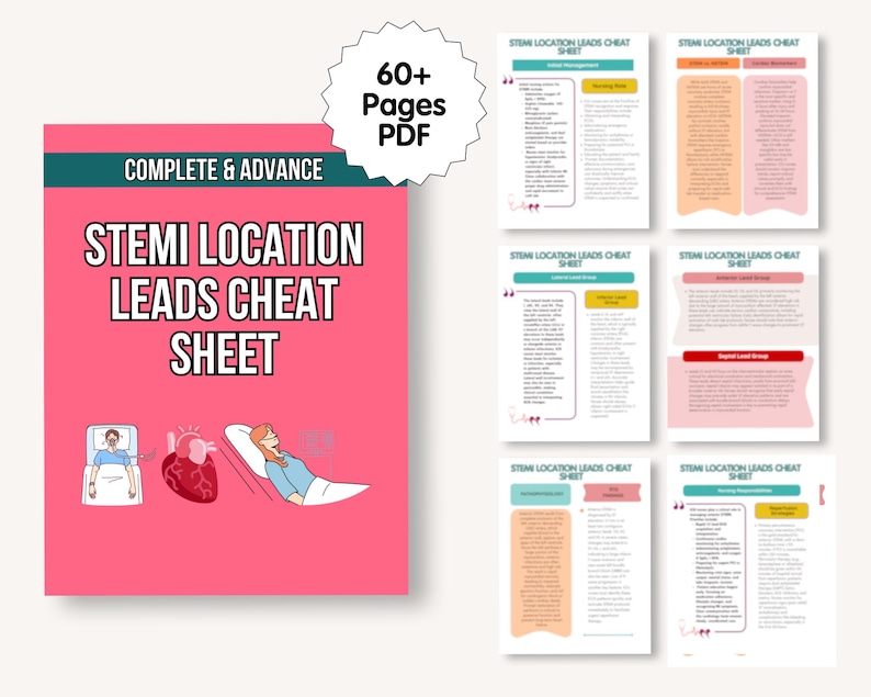 STEMI Location Leads Cheat Sheet | ECG Ekg MI Localization Guide ...