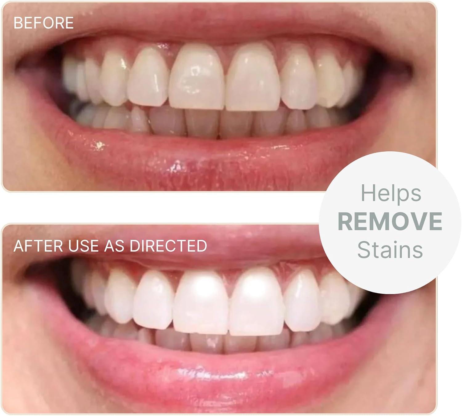 AP 24® Whitening Fluoride-free Toothpaste - Etsy