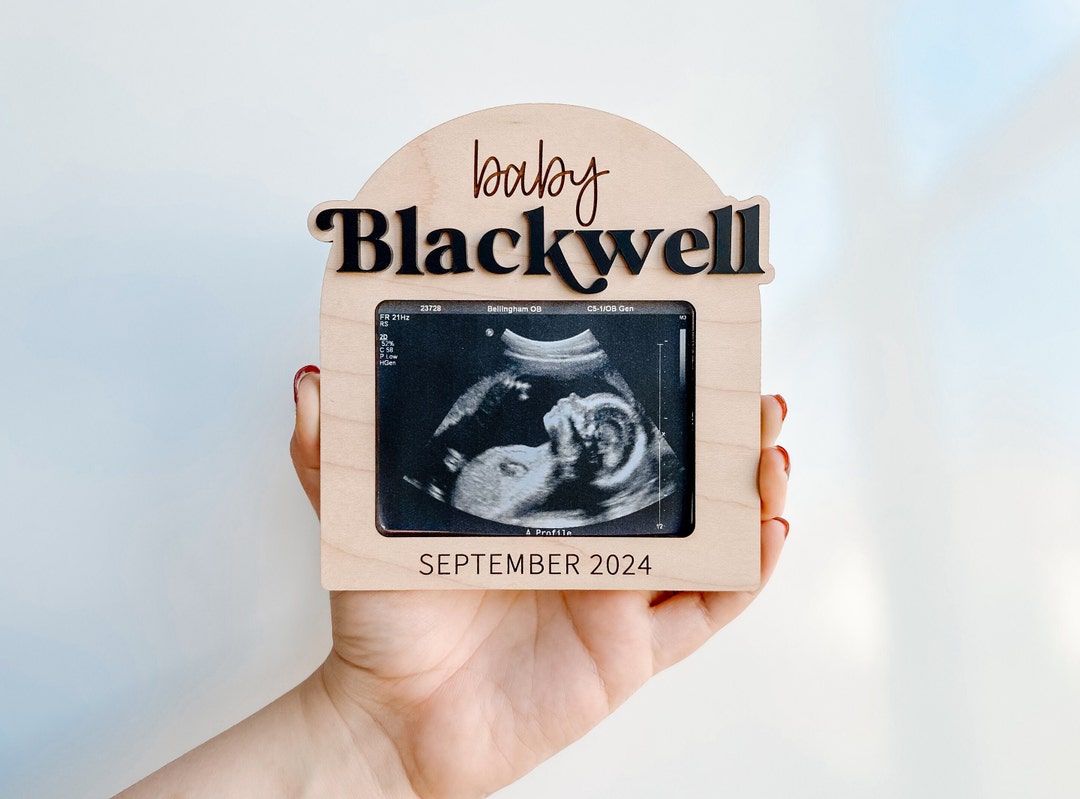 Personalized Magnetic Ultrasound Picture Frame Maternity Photo Frame ...