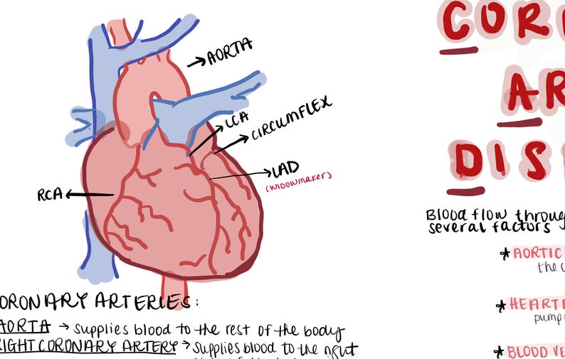 Coronary Artery Disease (CAD) - Etsy