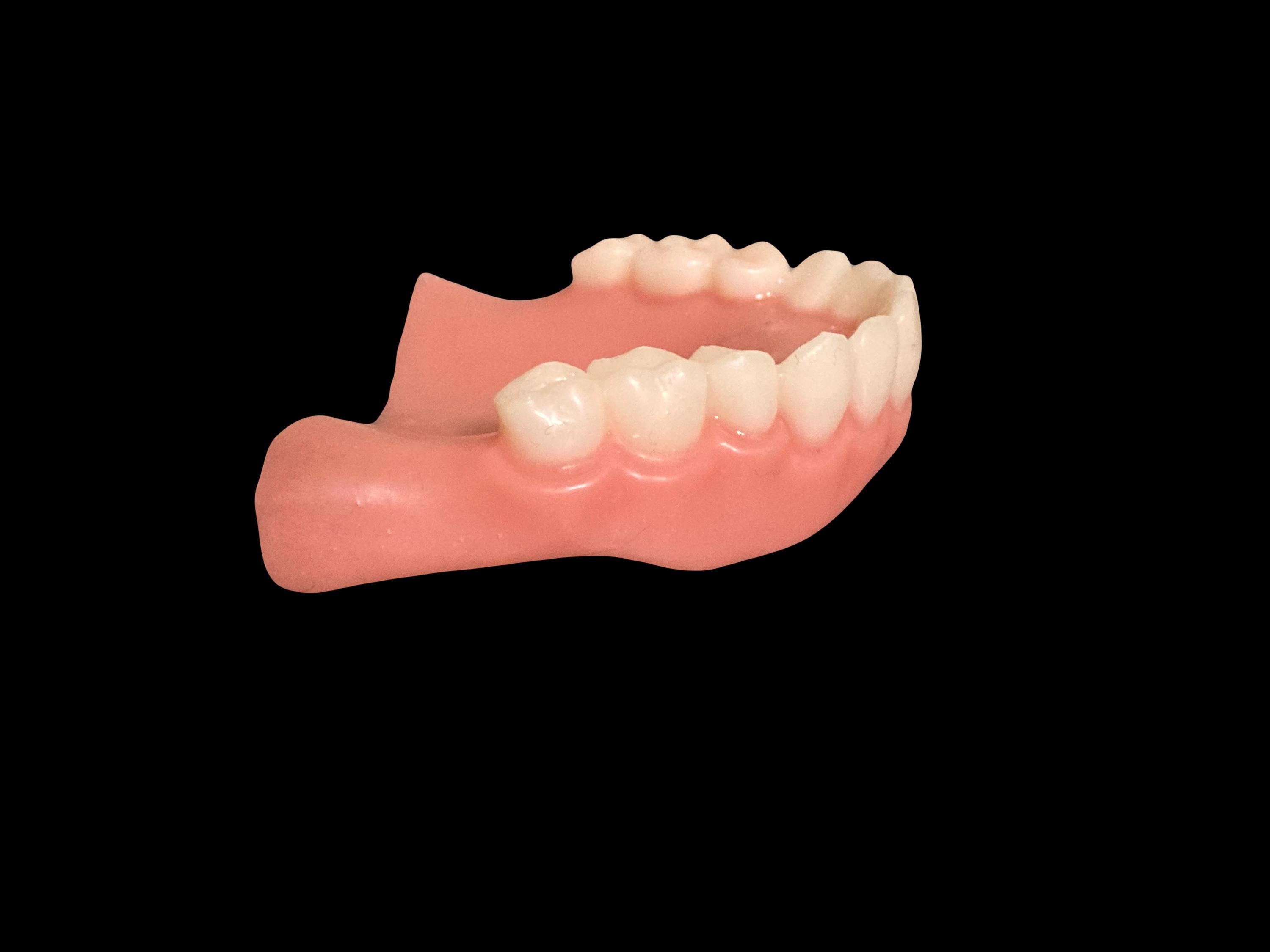 Upper Denture Sample Premade Small to Medium Size - Etsy