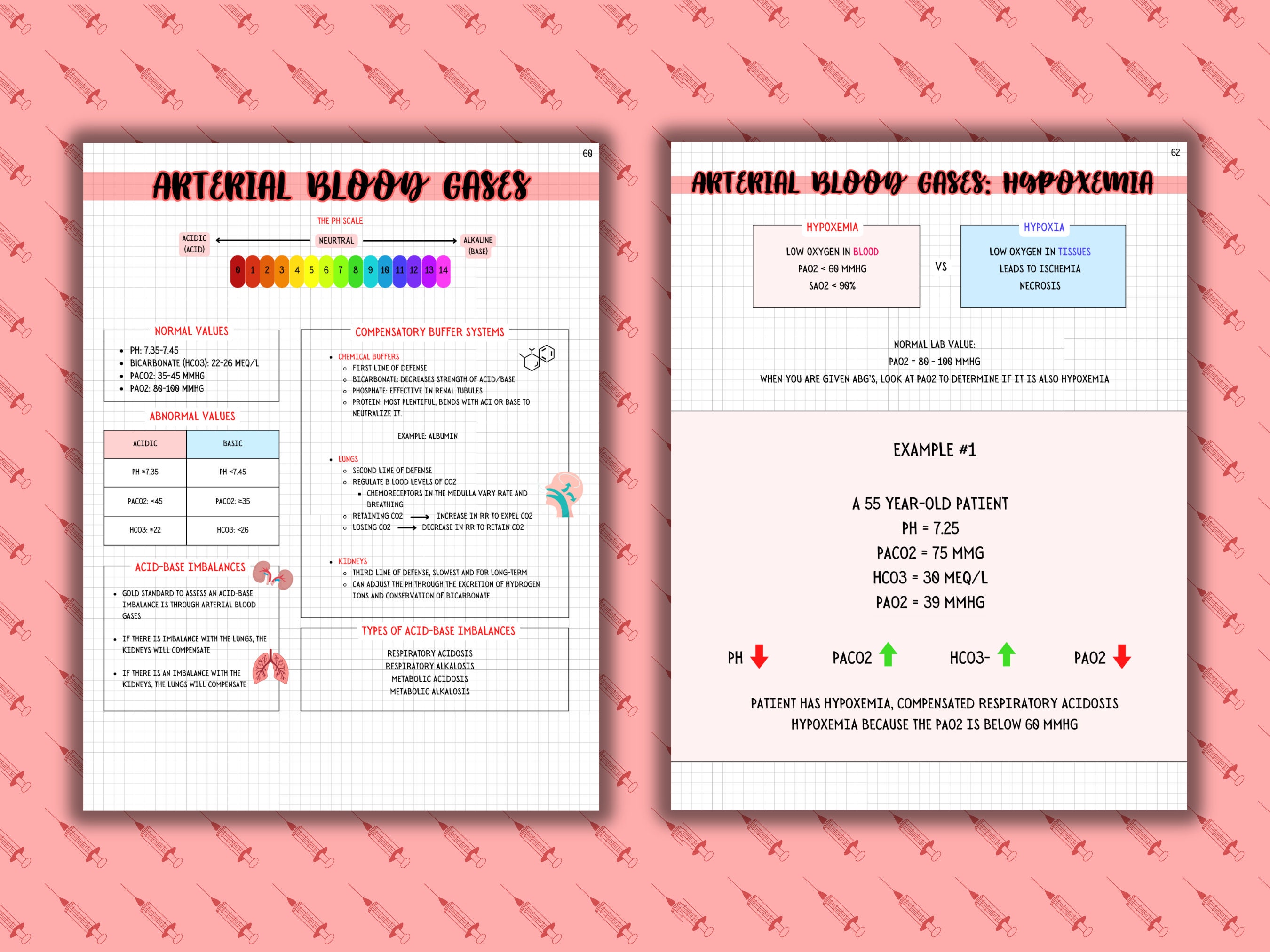 Arterial Blood Gases, Abgs, NCLEX, Nursing Notes, Nursing Fundamentals ... Arterial Blood Gases, Abgs, NCLEX, Nursing Notes, Nursing Fundamentals ...