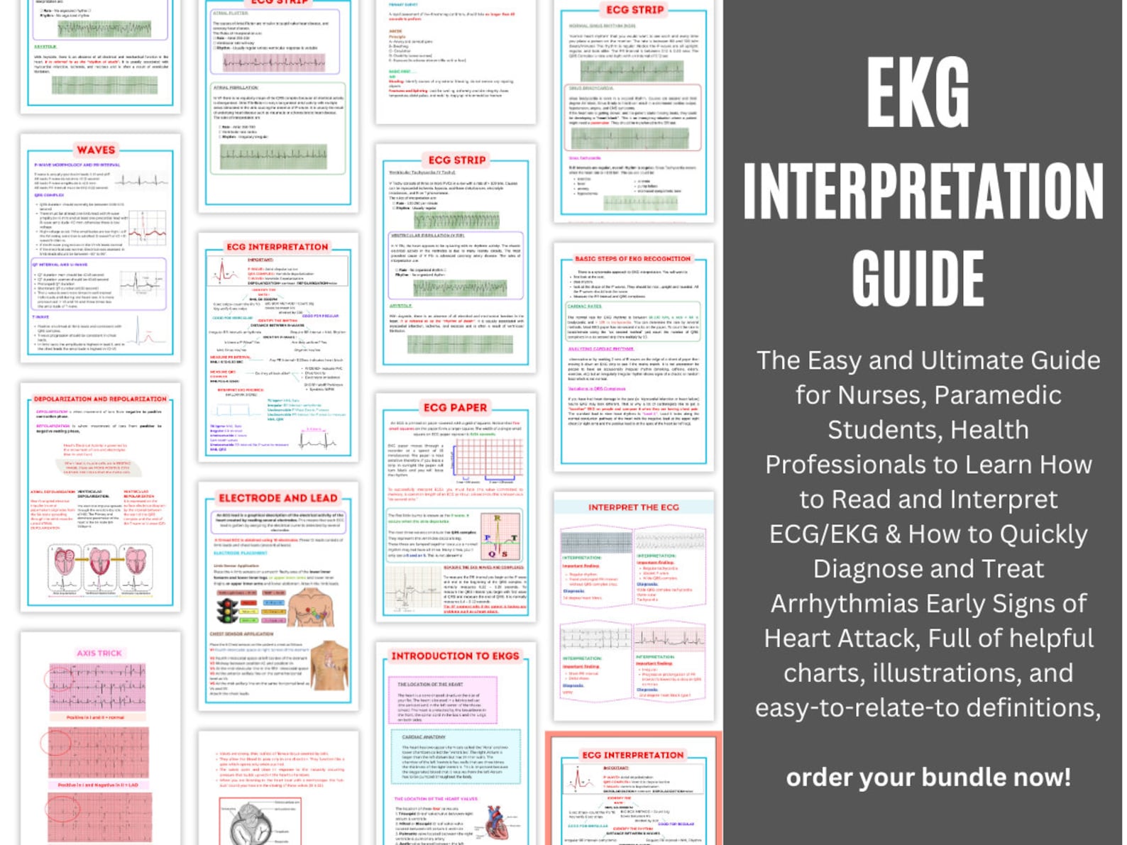 EKG Interpretation Guide – ECG Arrhythmia Cheat Sheets (digital ...