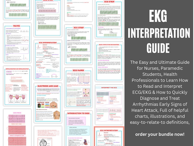 EKG Interpretation Guide – ECG Arrhythmia Cheat Sheets (digital ...