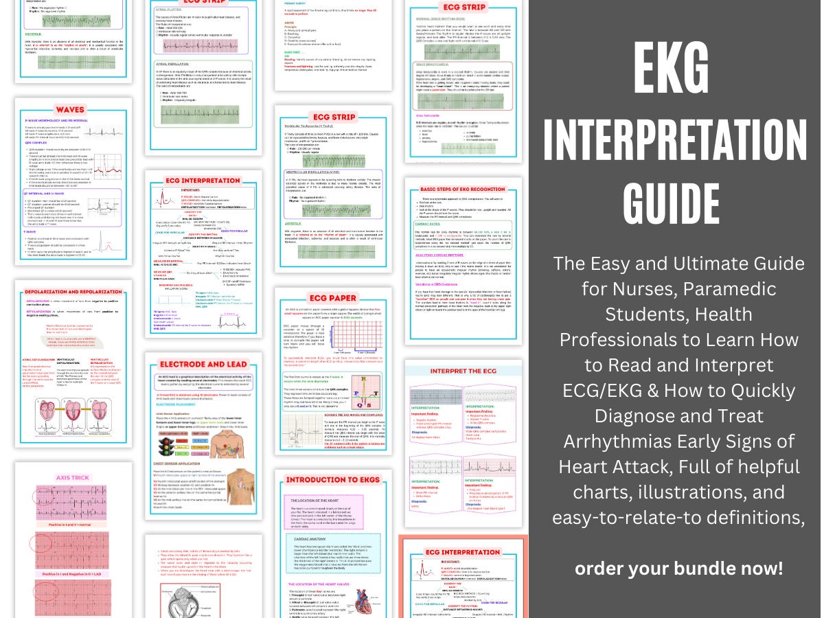 EKG Dysrhythmia Interpretation Guide- EKG Arrhythmia- ECG Rhythms ...
