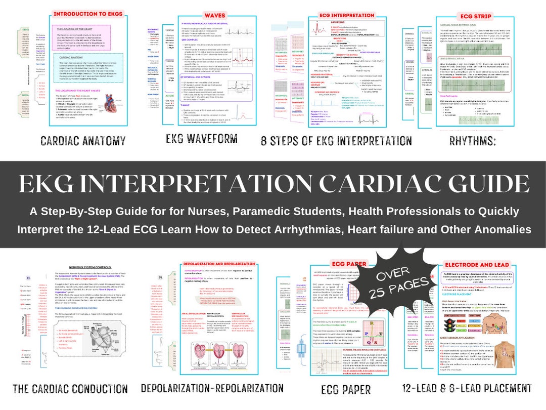 EKG Dysrhythmia Interpretation Guide- EKG Arrhythmia- ECG Rhythms ...