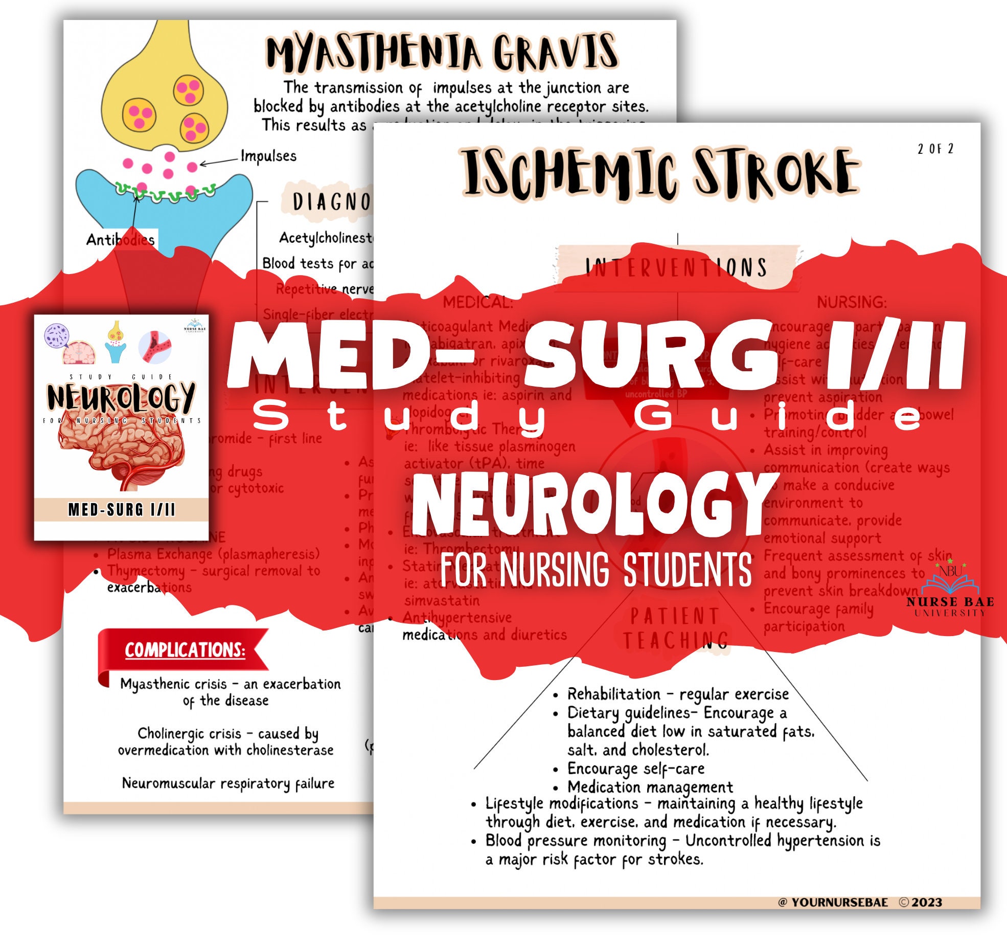 Neuro Study Guide, Nursing Med Surg I/II Neuro Bundle for Nursing ...