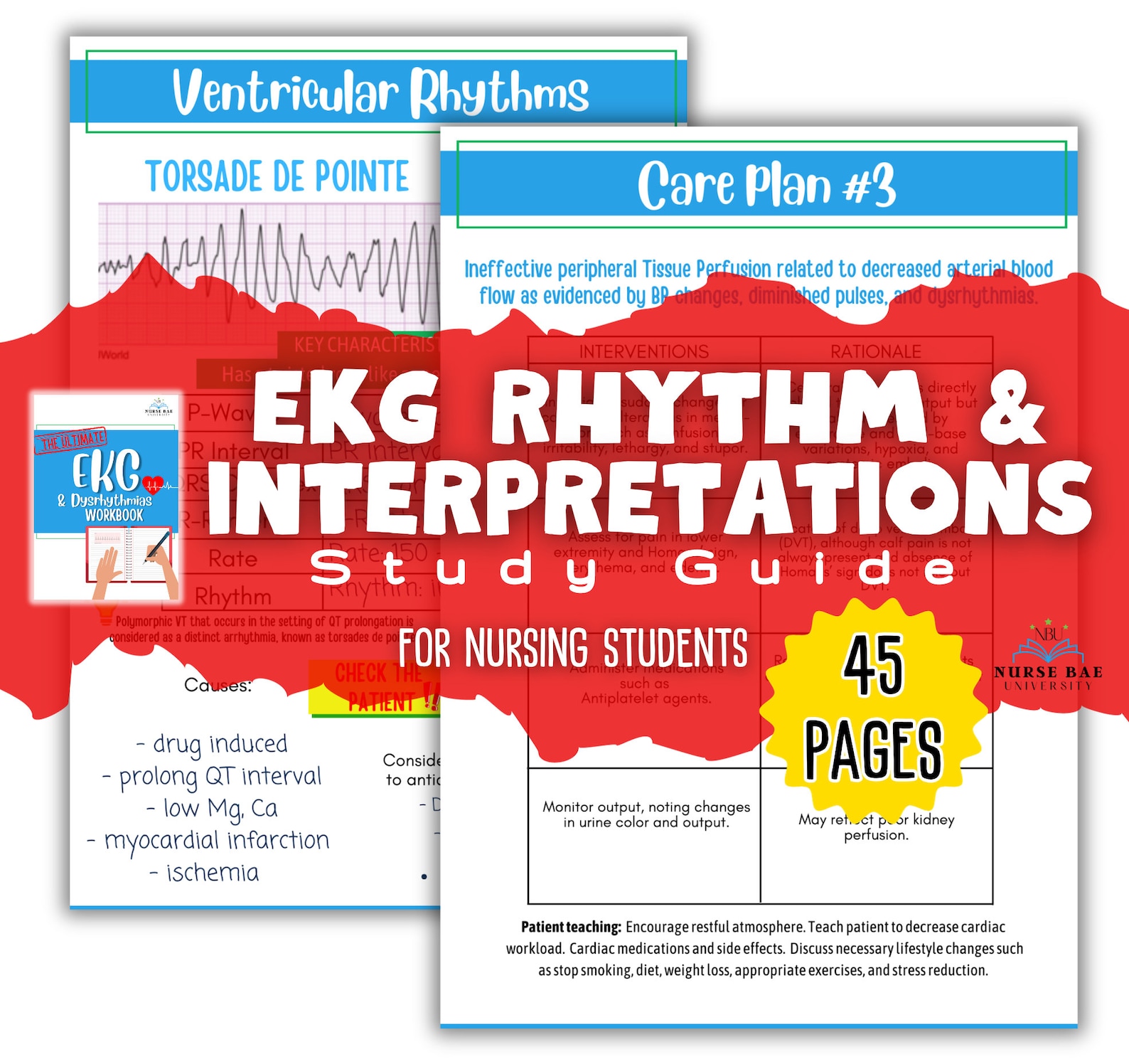 EKG Study Guide: Nursing Students, BLS/ACLS Rhythms, Careplans (45-page ...