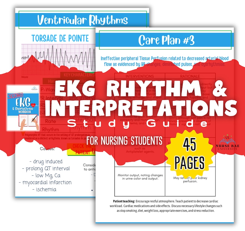 EKG Study Guide: Nursing Students, BLS/ACLS Rhythms, Careplans (45-page ...