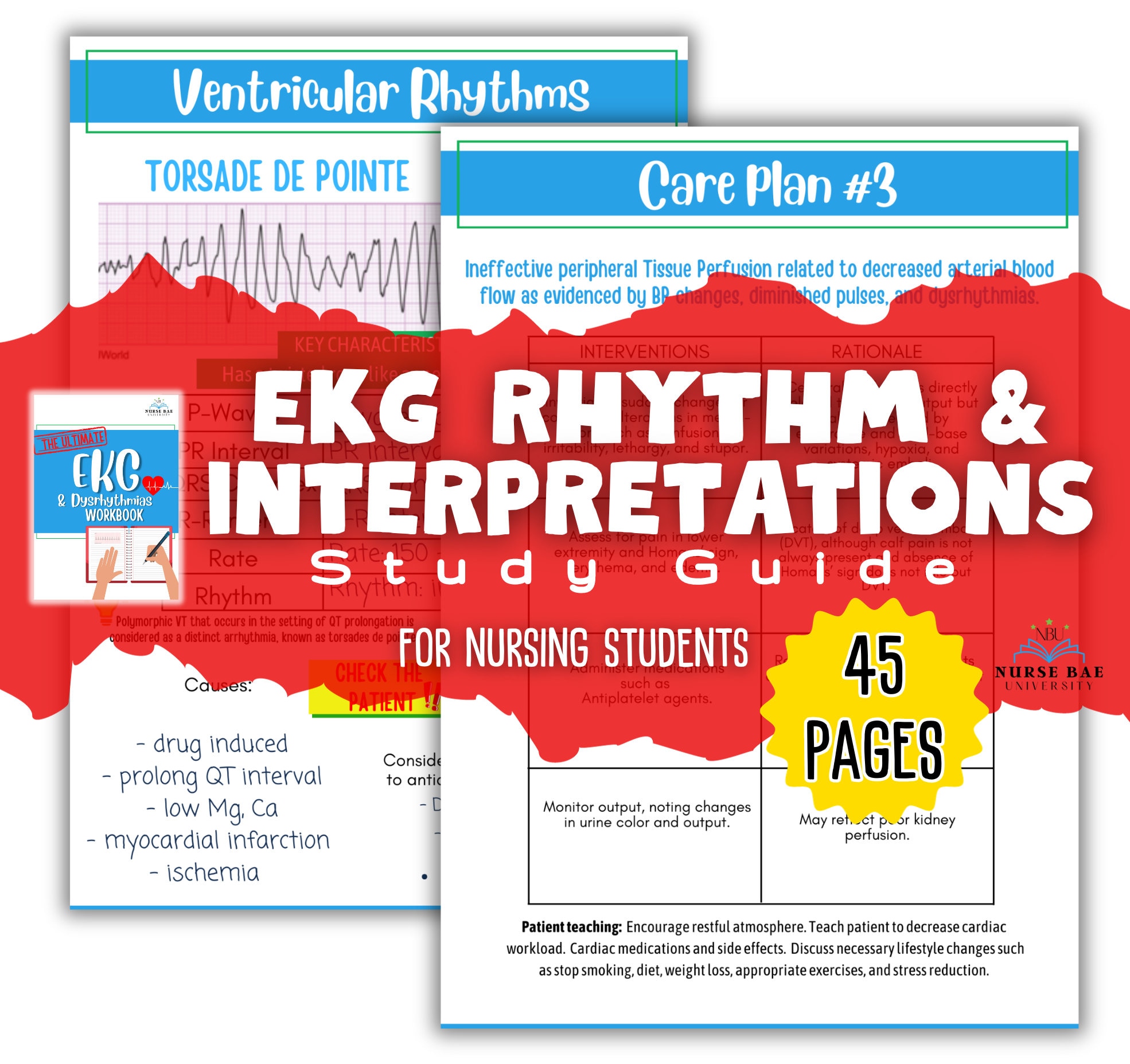EKG Study Guide: Nursing Students, BLS/ACLS Rhythms, Careplans (45-page ...