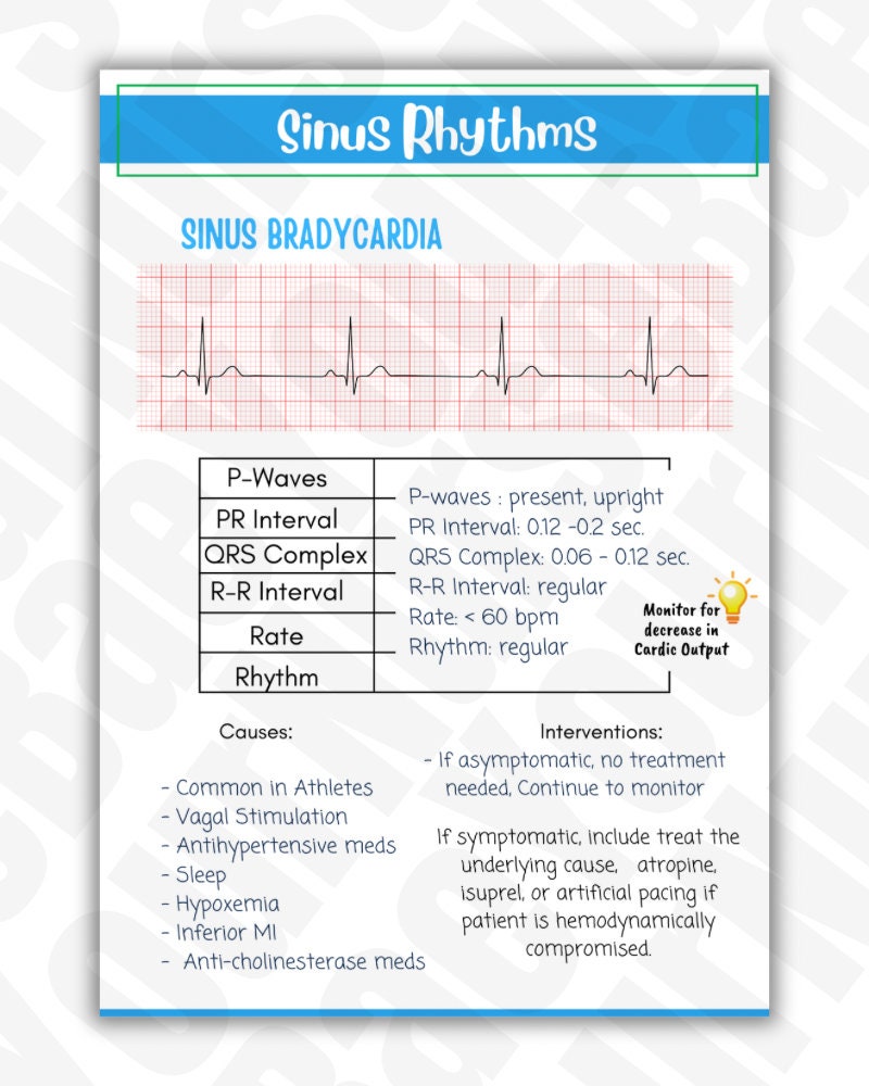 EKG Study Guide: Nursing Students, BLS/ACLS Rhythms, Careplans (45-page) - Etsy