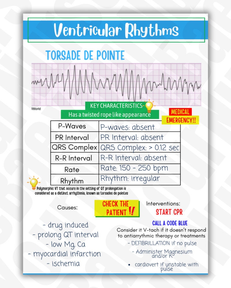 EKG Study Guide: Nursing Students, BLS/ACLS Rhythms, Careplans (45-page) - Etsy