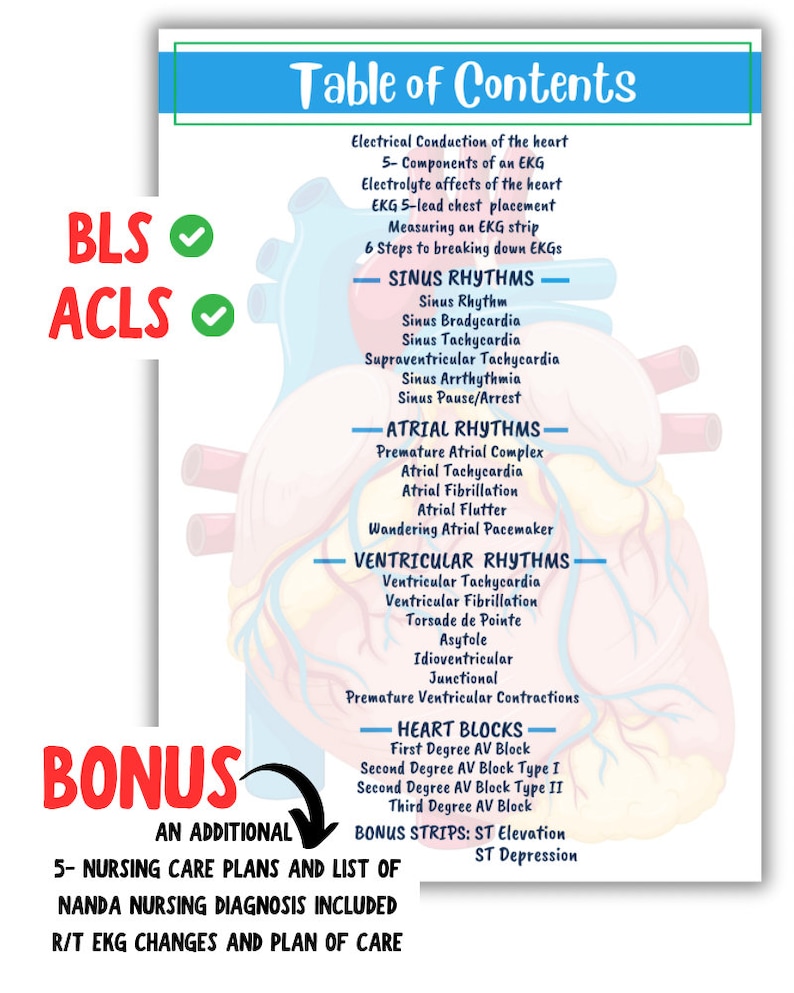 EKG Study Guide: Nursing Students, BLS/ACLS Rhythms, Careplans (45-page ...
