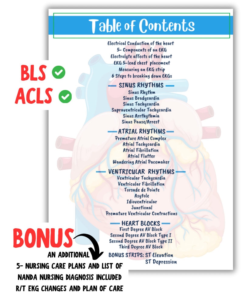 EKG Study Guide: Nursing Students, BLS/ACLS Rhythms, Careplans (45-page) - Etsy