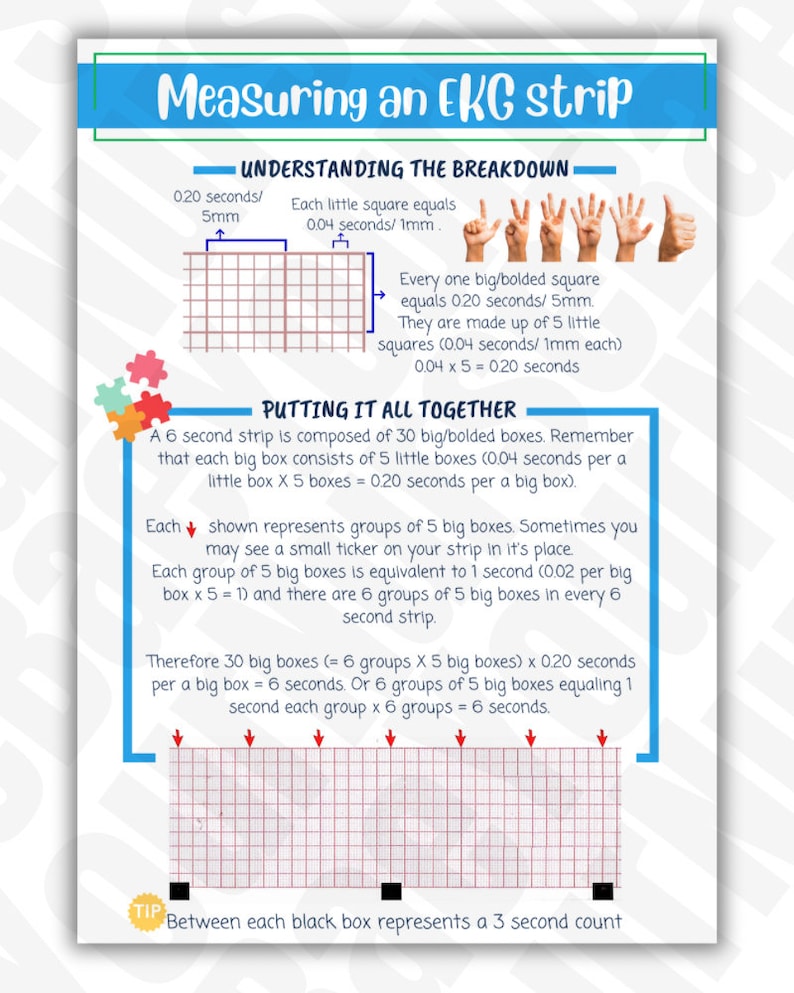 EKG Study Guide: Nursing Students, BLS/ACLS Rhythms, Careplans (45-page) - Etsy