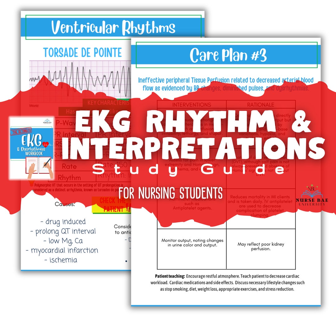 EKG Study Guide for Nursing Students BLS/ACLS Rhythms - Etsy Australia