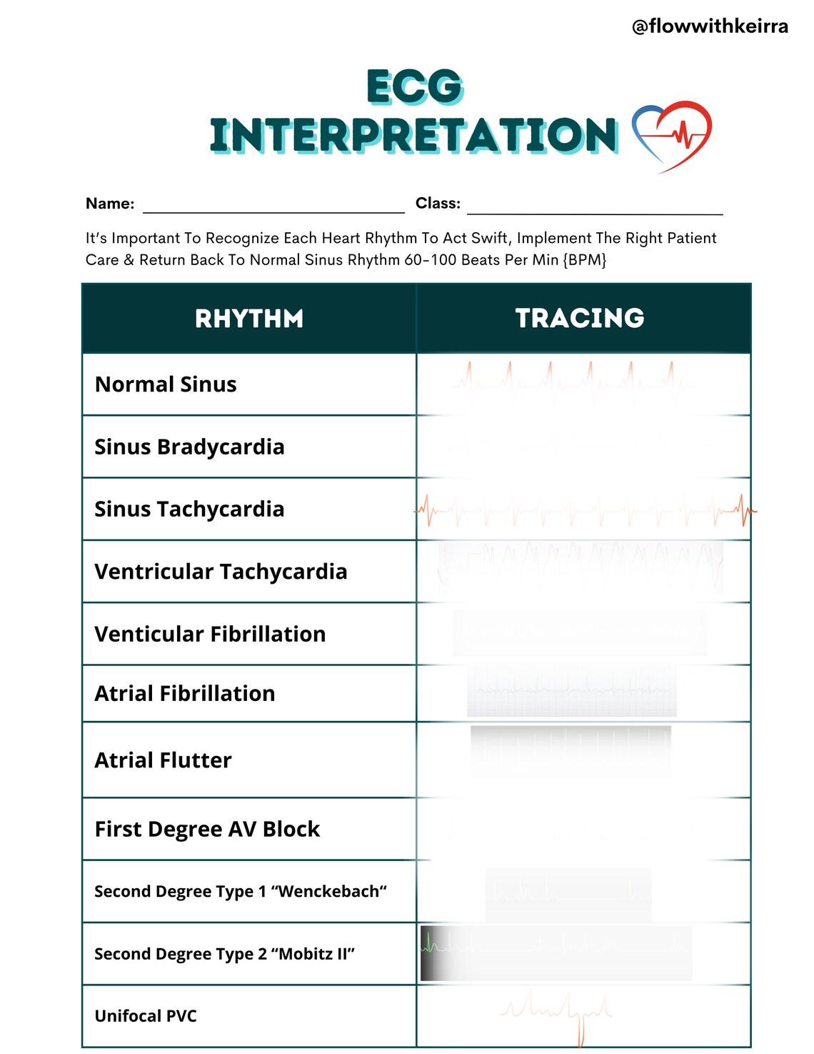 ECG Interpretation Cheat Sheet - Etsy