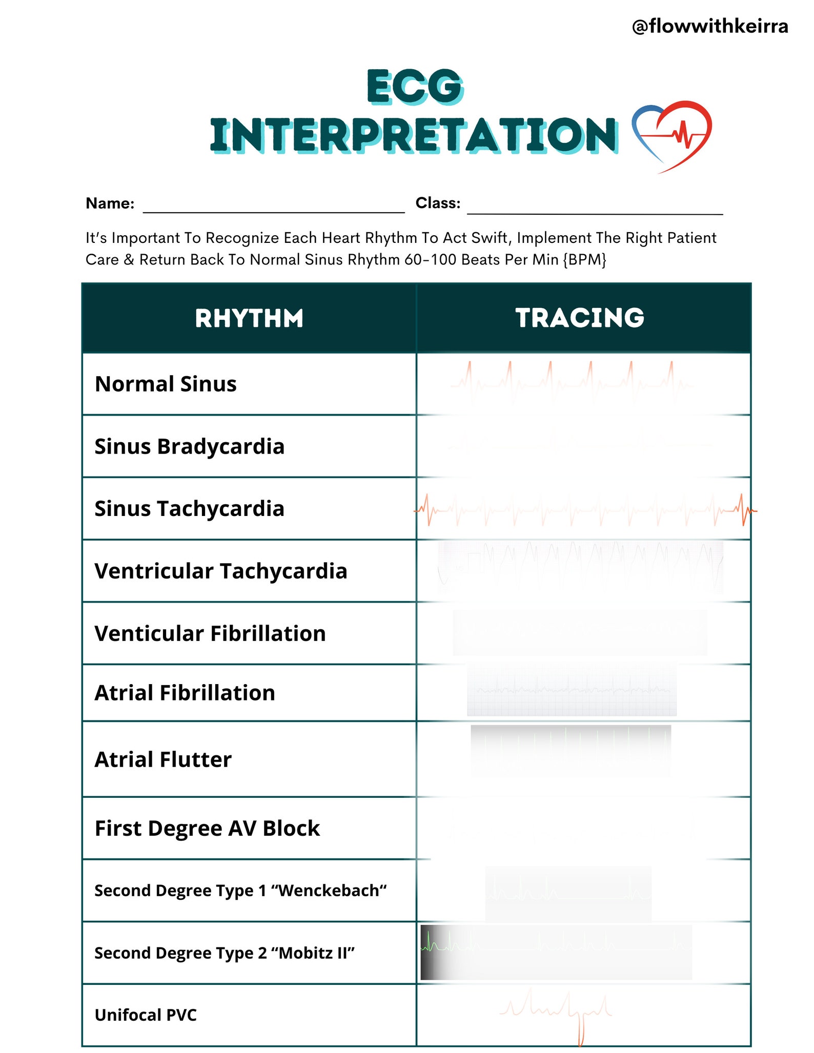 ECG Interpretation Cheat Sheet - Etsy