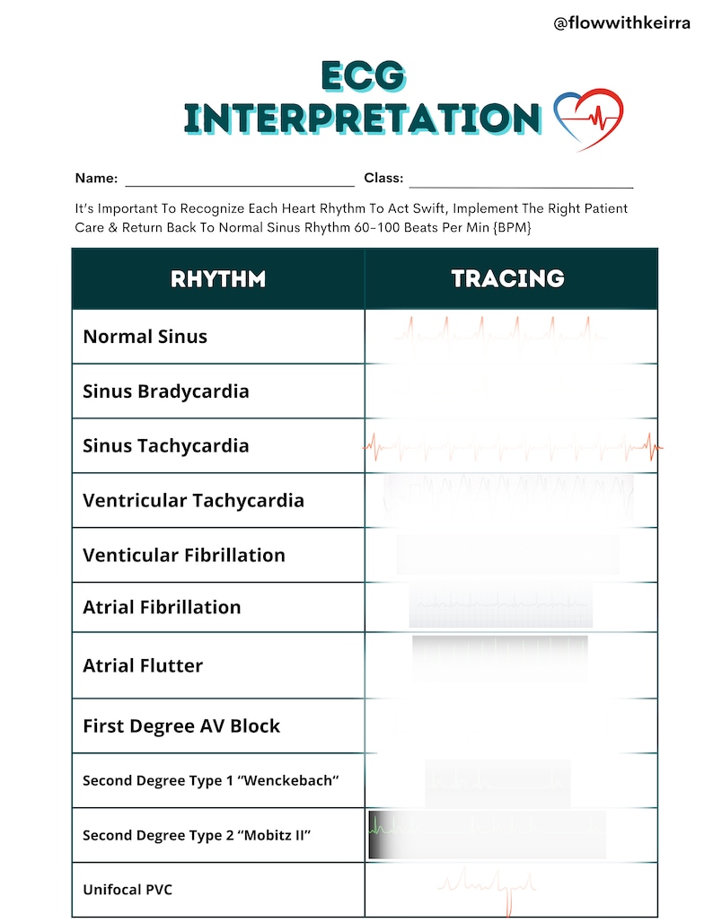 ECG Interpretation Cheat Sheet - Etsy