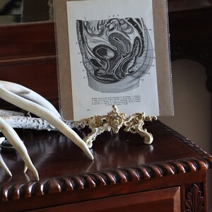 Midline View of the Pelvic Structures in the Female Anatomy - Etsy