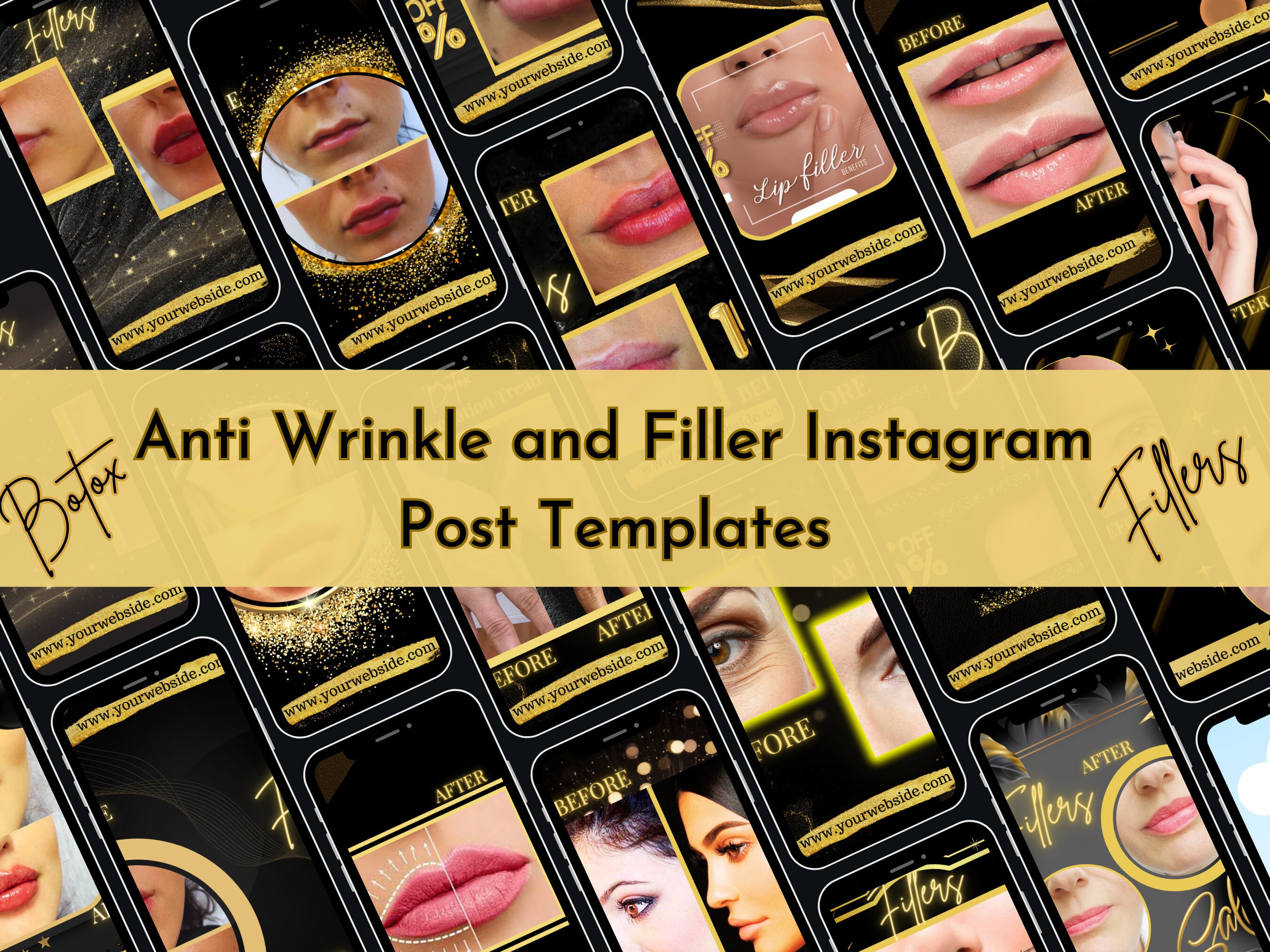 Luxury Nurse Injector Instagram Templates, Anti Wrinkle Instagram Post ...