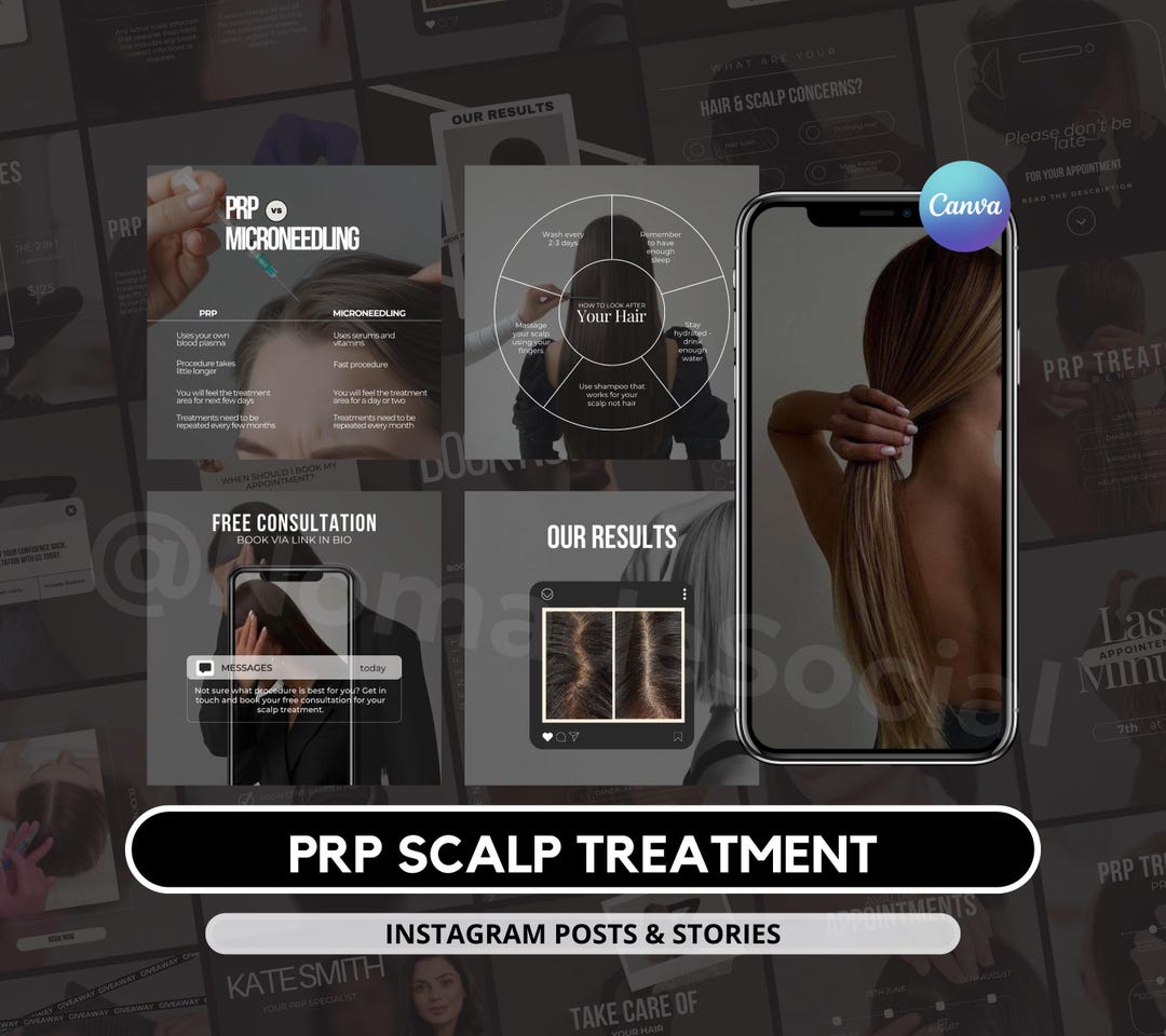 PRP Scalp Treatment Instagram Templates: Hair Loss Posts and Stories ...
