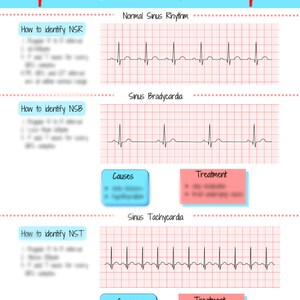 EKG Study Guide - Etsy