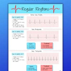 EKG Study Guide - Etsy