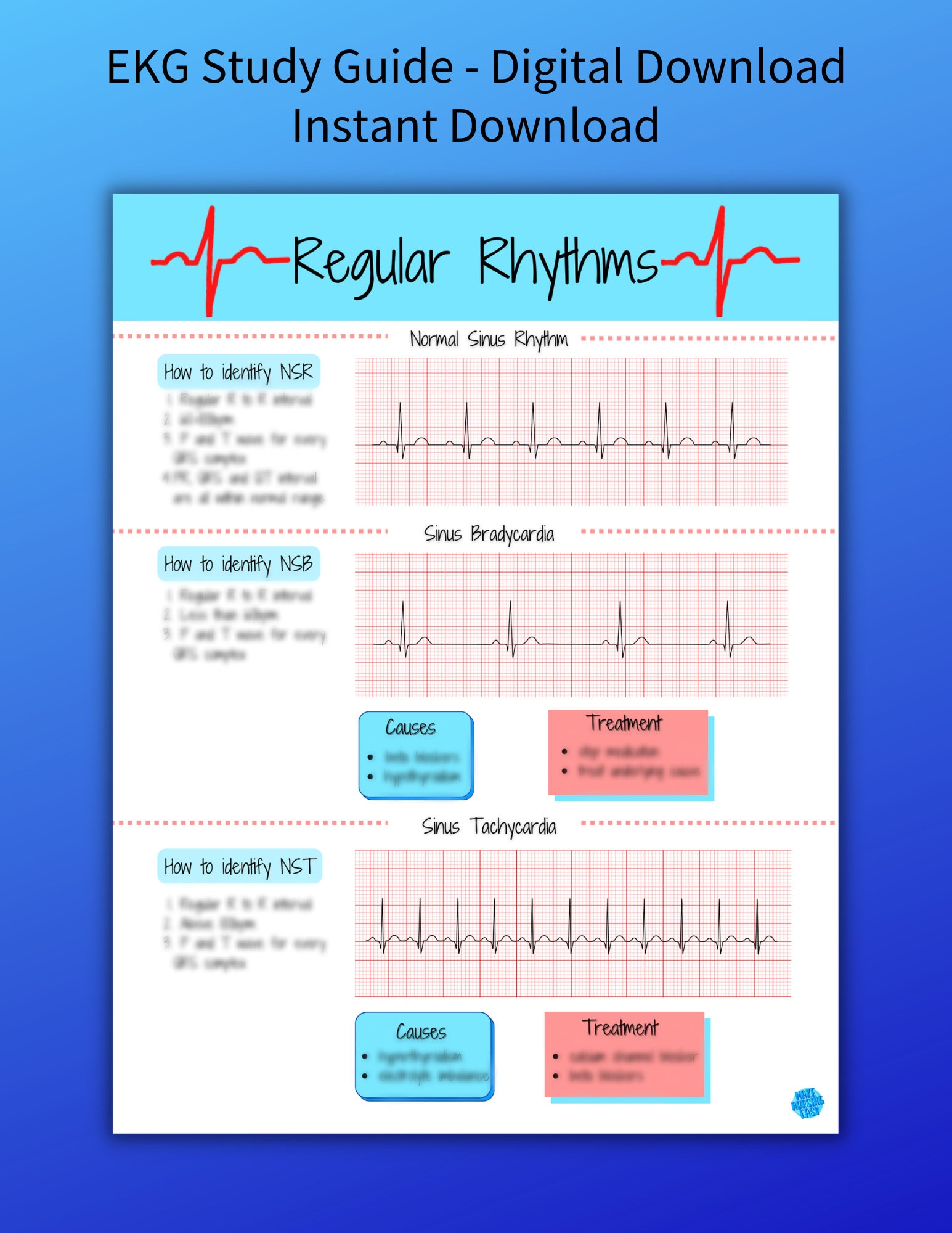 EKG Study Guide - Etsy
