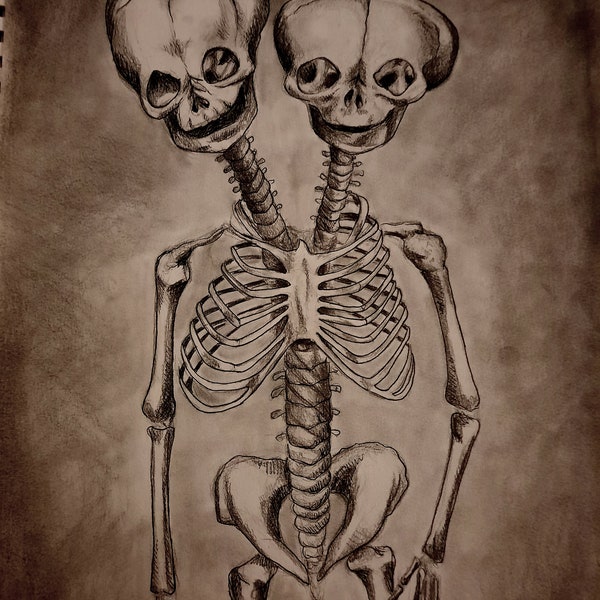 Conjoined Twins - Etsy