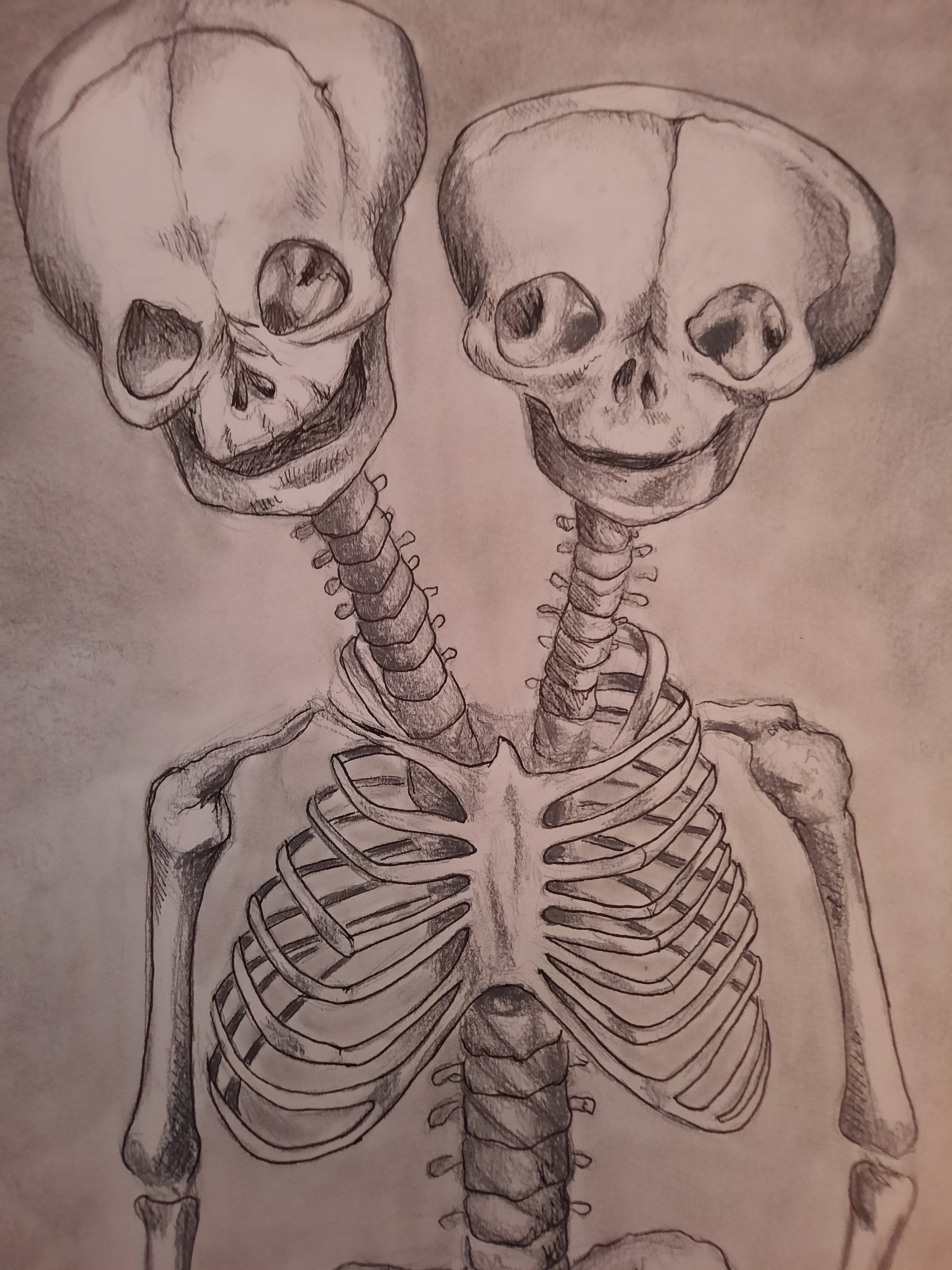 Conjoined Twins Drawing, Graphite Drawing, Goth Art, 11x14, Dark Art ...