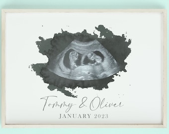 Ultrasound Scan 3d - Etsy