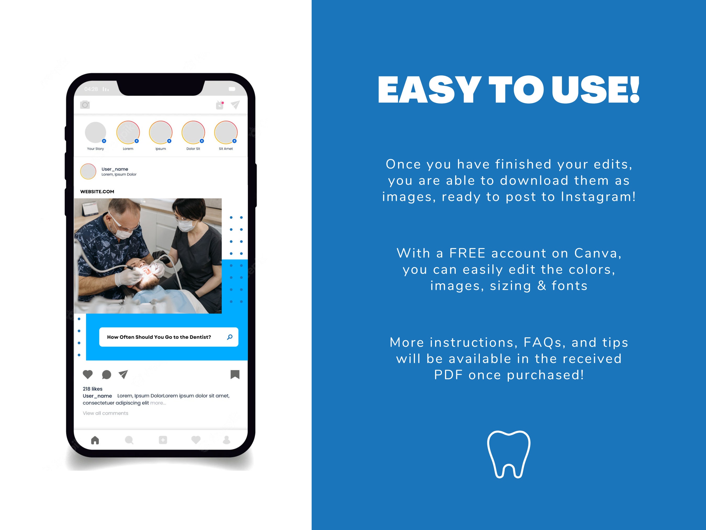 50 Dental Instagram Post Templates | Dentist Dental Clinic Social Media ...