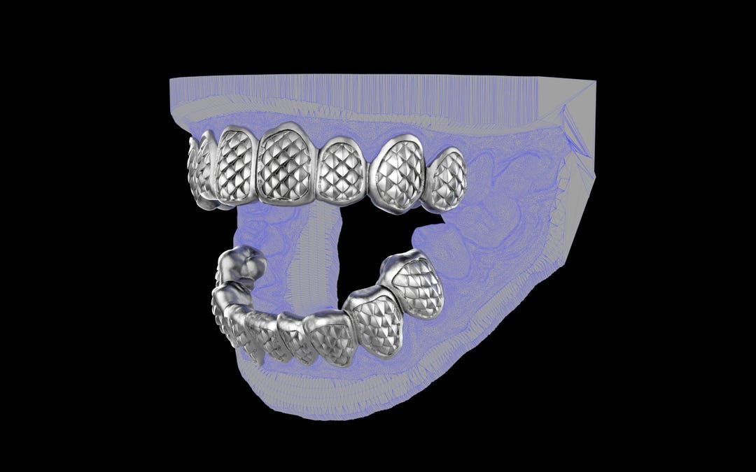 Custom Grillz / Tooth Caps - Fish Scale Cut - Etsy